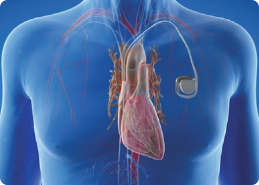 Upcoming webinars - DIRECT HF